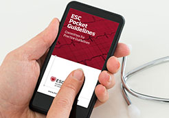 ESC Guidelines Derivative Products